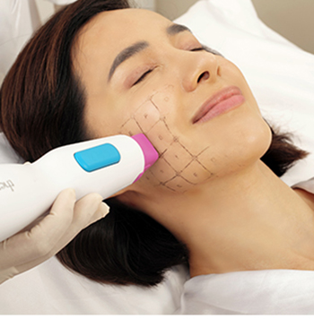 Luminisce Services | Luminisce Skin and Laser Clinic